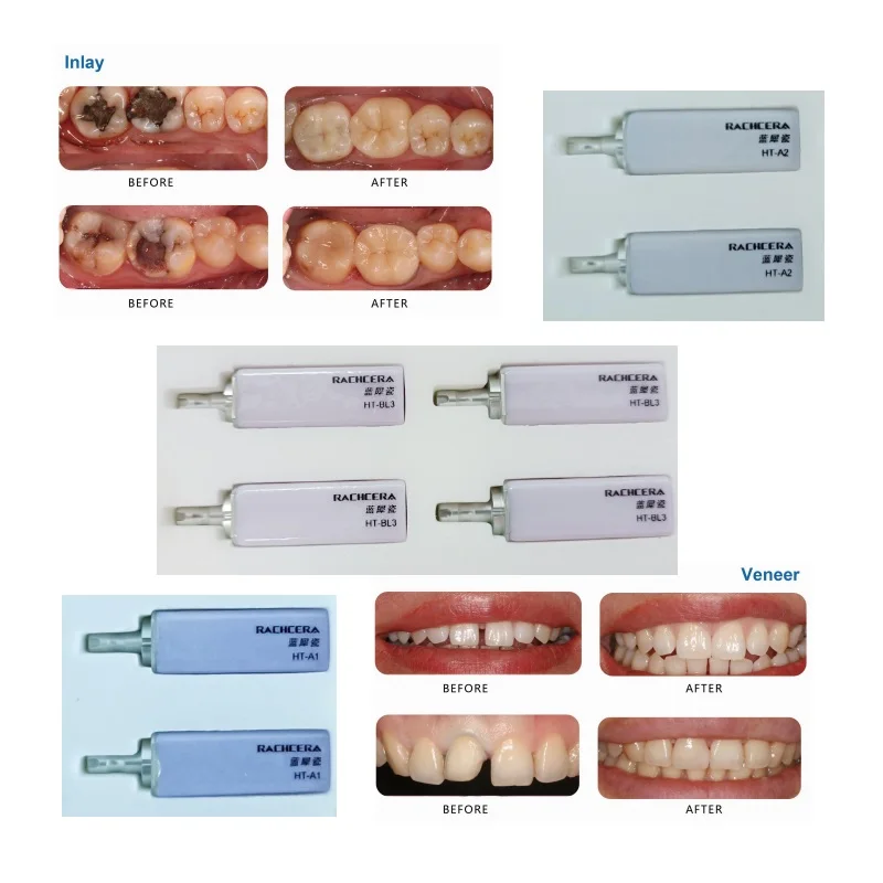 4PCS-Aesthetic-Restoration-CAD-CAM-Dental-Lithium-Glass-Ceramic-Block ...