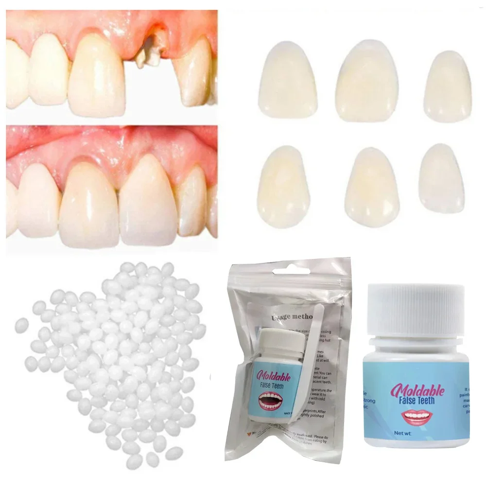 20g-Temporary-Tooth-Repair-Kit-Teeth-And-Beauty-Teeth-To-Adhesive-Gaps ...