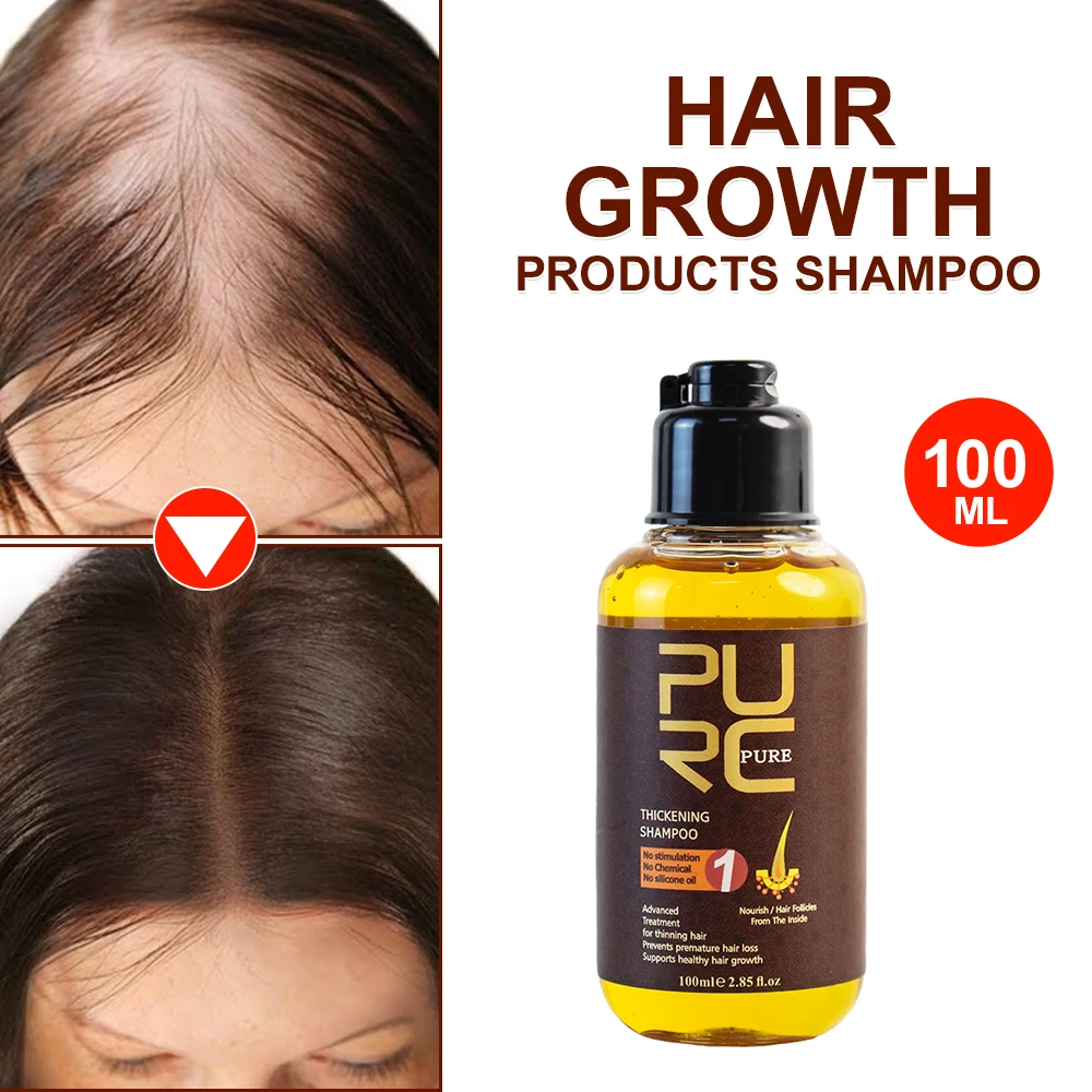 Hair-Growth-Products-Shampoo-Anti-Hair-Loss-Ginger-Essence-Nourishing ...