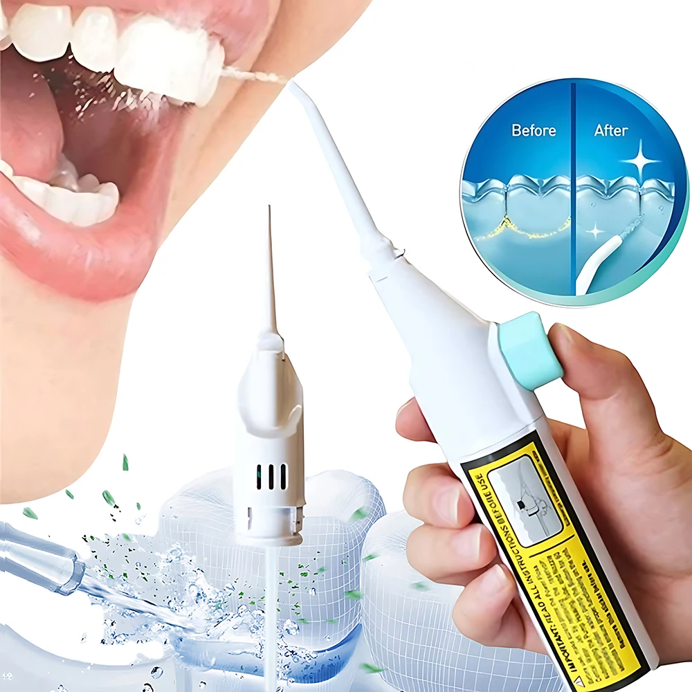 Dental-Washer-Portable-Oral-Irrigator-Tooth-Dyeing-Braces-Cleaner ...
