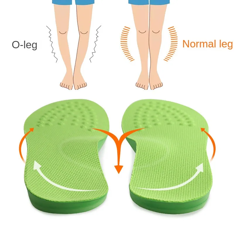 New-Orthotic-Insoles-XO-Legs-for-Support-Shoes-Inserts-Outer-Foot-Women ...