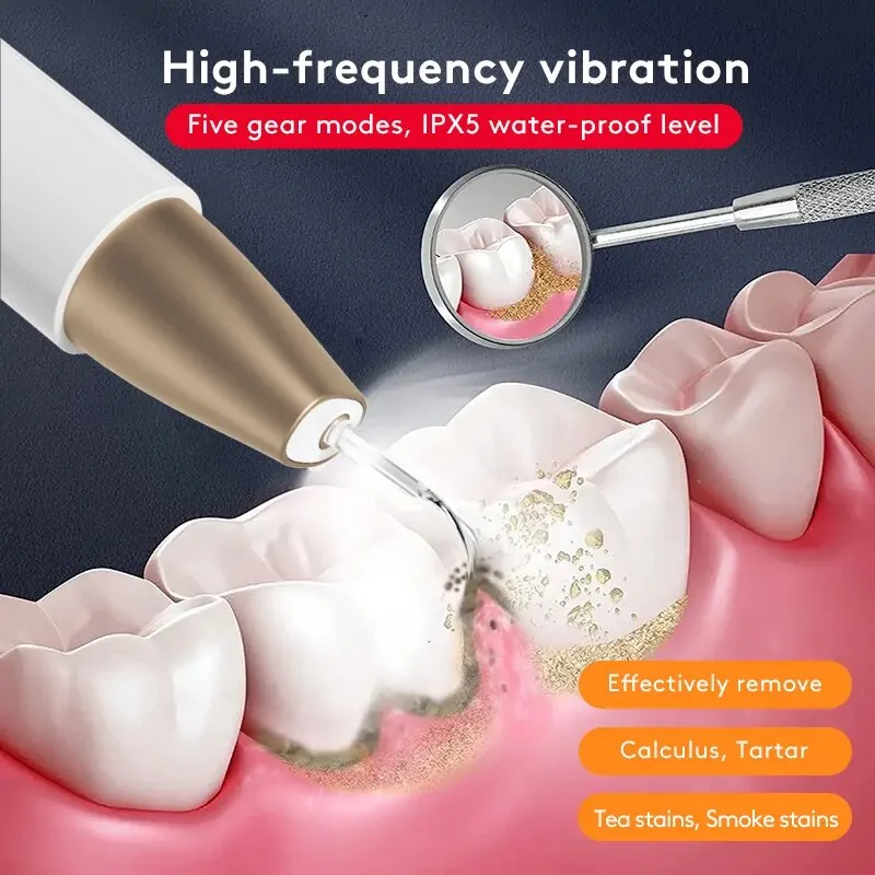 Ultrasonic-Dental-Scaler-For-Teeth-Tartar-Stain-Tooth-Calculus-Remover ...