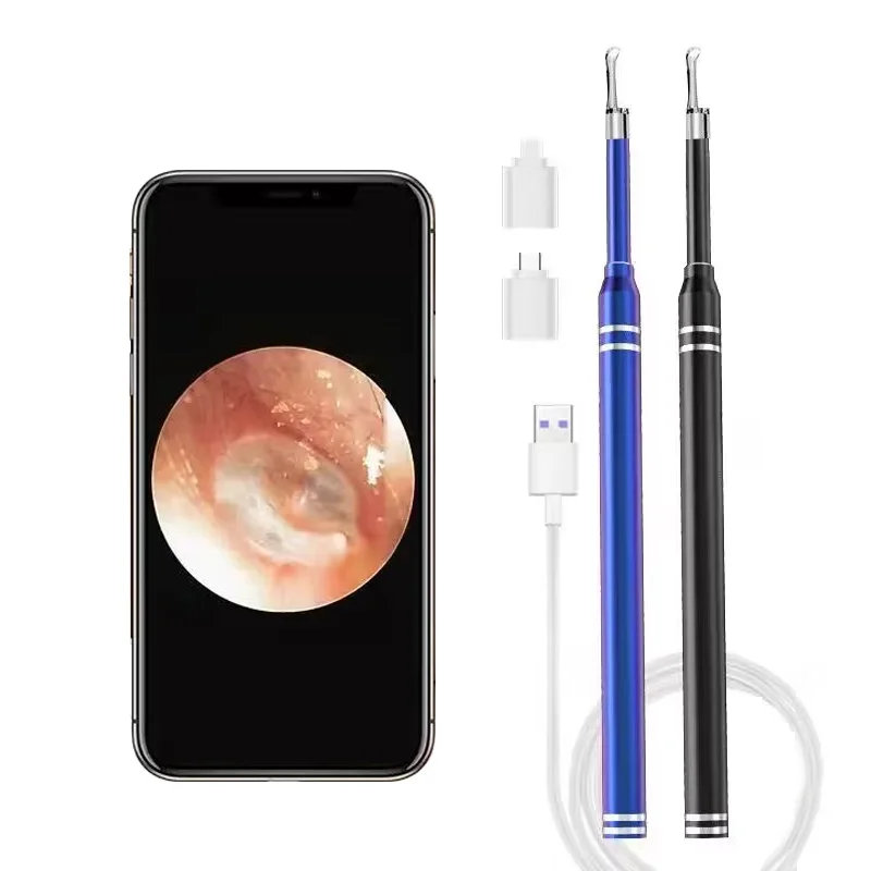 Smart-Ear-Cleaner-Endoscope-5-5mm-3-in-1-Ear-Otoscope-Earwax-Remover ...