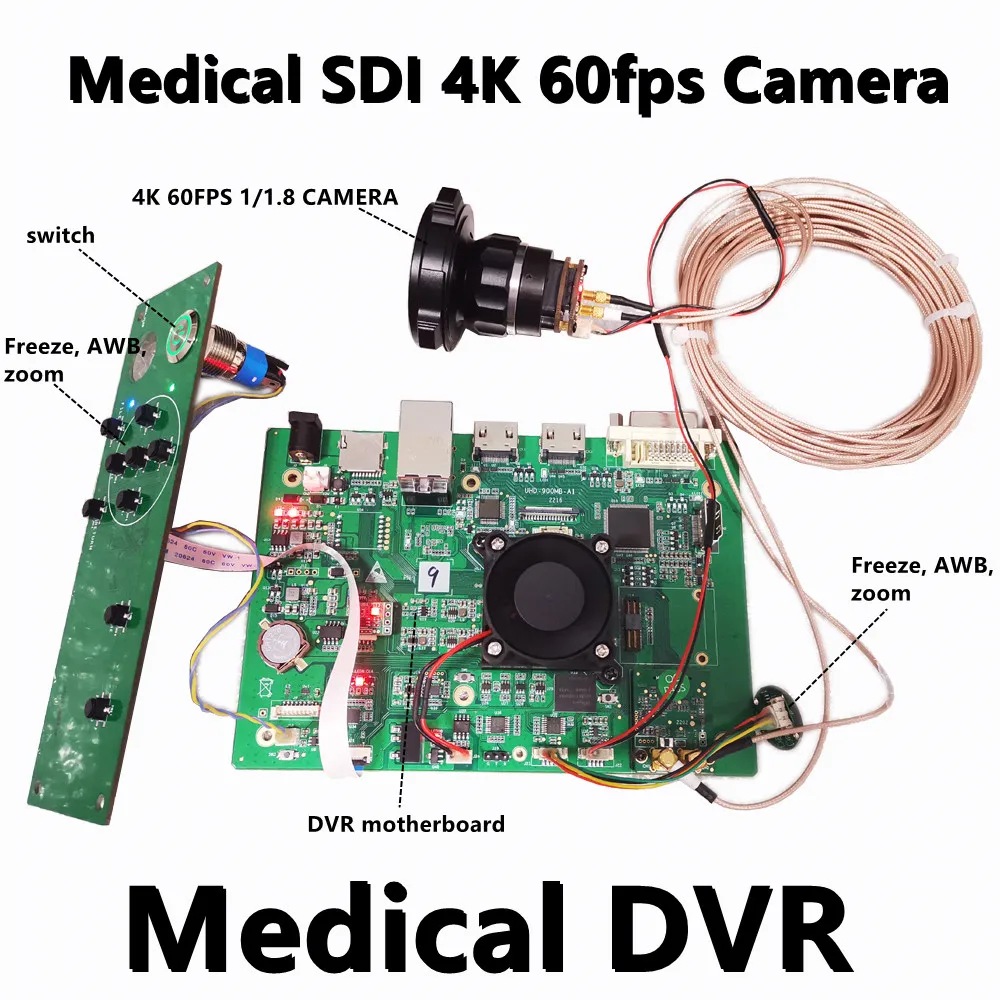 의료용 SDI 카메라 DVR 내시경 카메라 모듈, 맞춤형 PCB 보드, SDI 모듈 카메라, 자동 초점, 4K 60fps ...