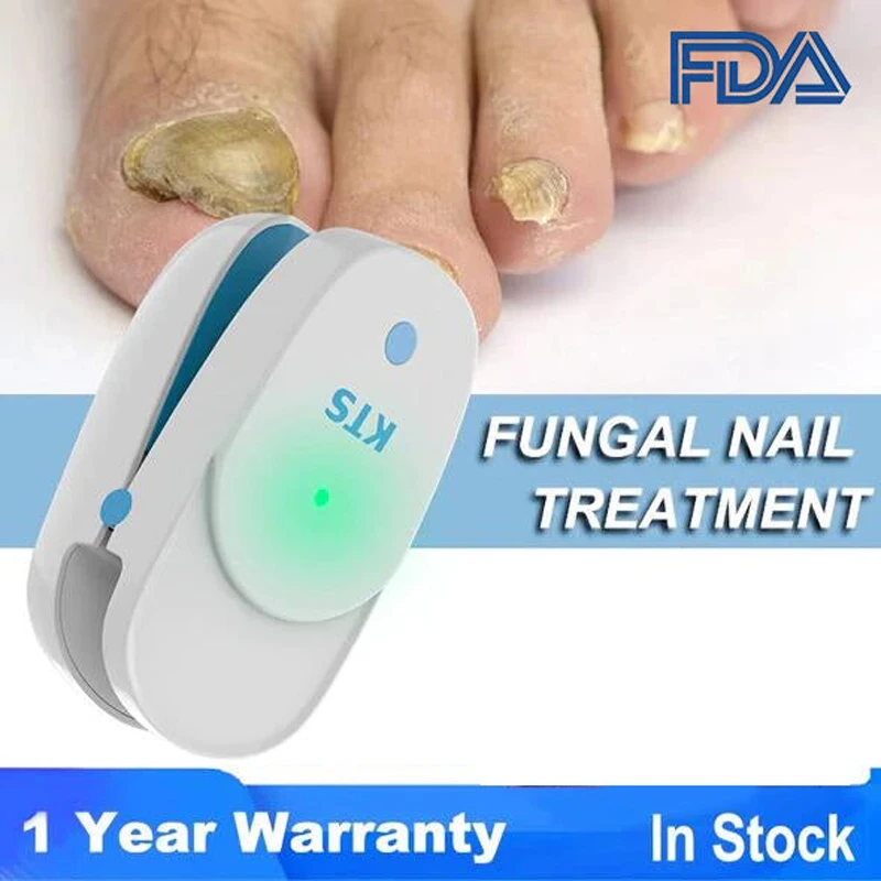 Fungal Nail Treatment Laser Device For Nail Fungus Removal – HT Mall