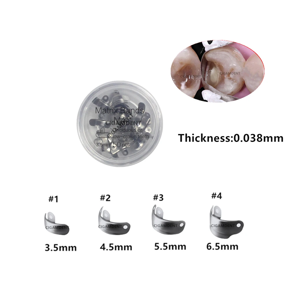 100Pcs Dental Matrix Bands Sectional Contoured Matrices Matrix Ring ...