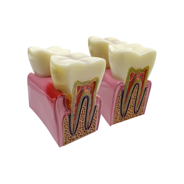 Modelo Anatómico De Los Dientes