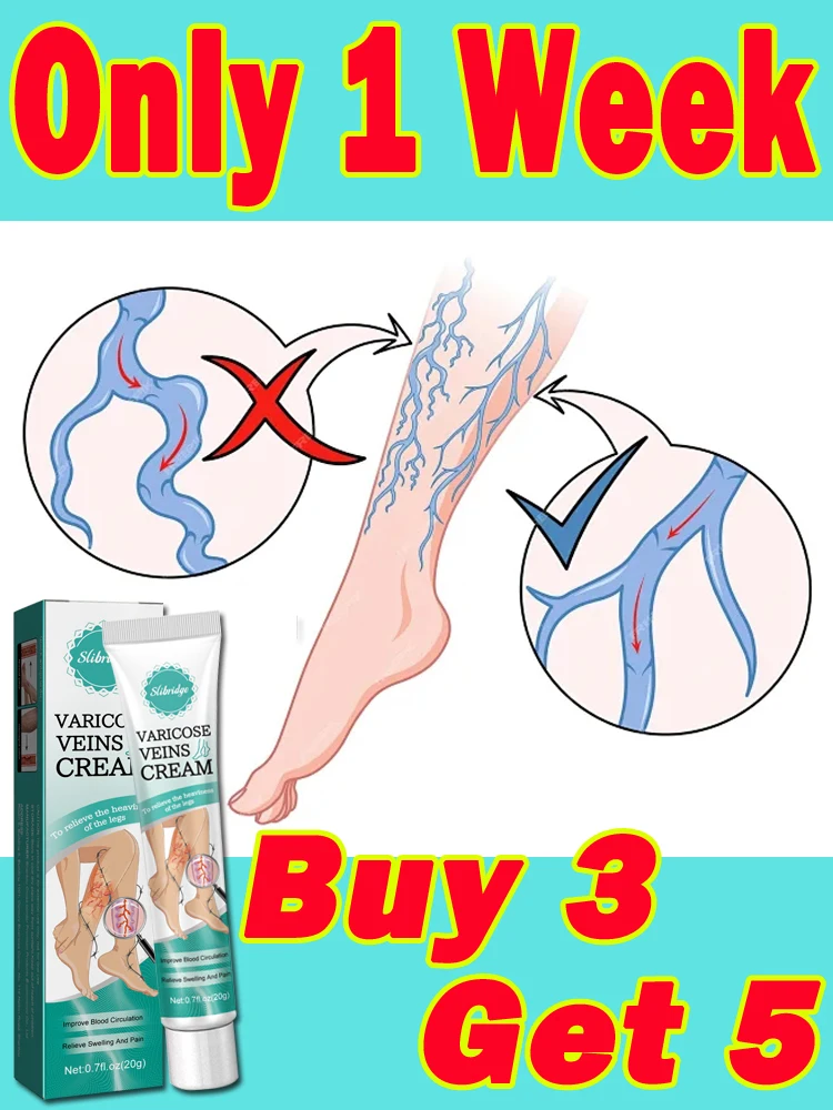La-pommade-contre-les-varices-soulage-efficacement-les-varices-et ...