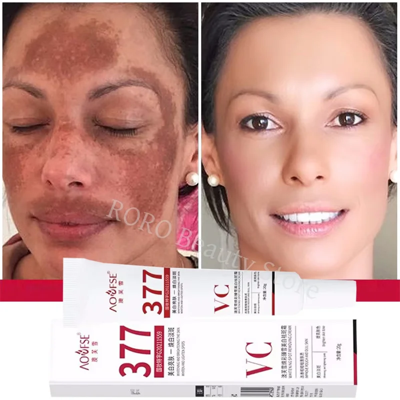 Niacinamide-Melasma-Brightening-Cream-Reduce-Melanin-Brighten-Cream ...