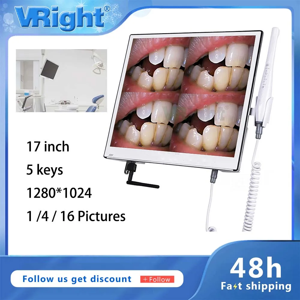 C-mera-Intraoral-Dent-ria-com-Monitor-Tela-LCD-Digital-HD-WiFi-10-Milh ...