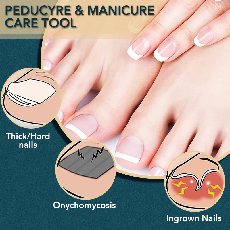 Ingrown Fingernail Cuticle