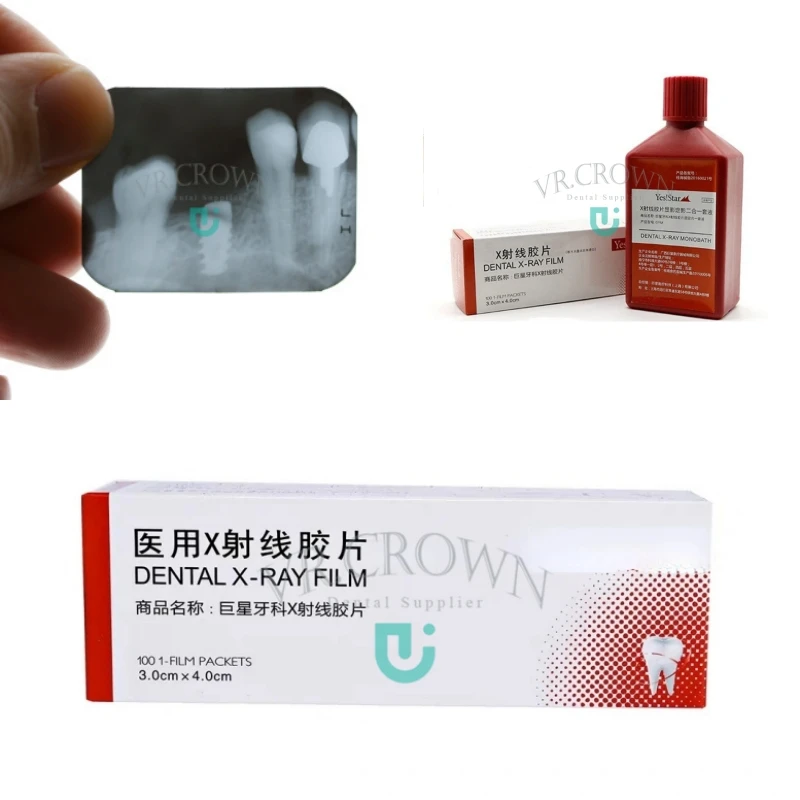 YES-STAR-Dental-X-Ray-Film-Yes-Star-Injectable-X-Ray-Films-Kit ...