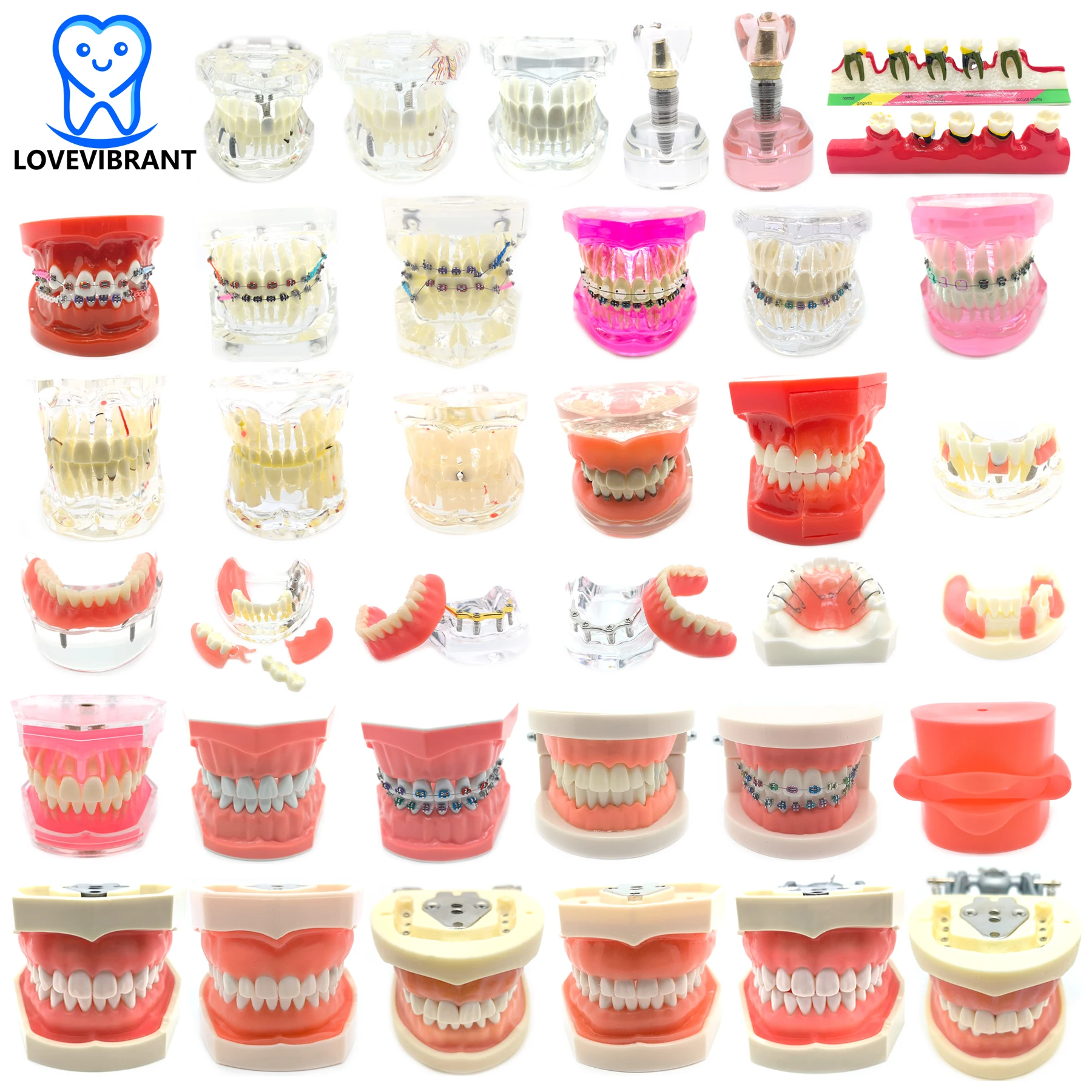 Dental Disease Teeth Model Implant Tooth Orthodontic Demo Model For ...