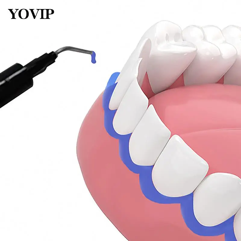 Barrera-Gingival-profesional-para-blanqueamiento-Dental-Gel-Protector ...