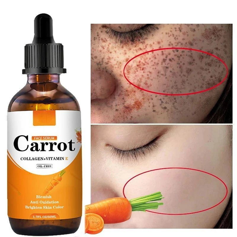 New Carrot Essence Essential oils Dark Spot Corrector Face Whitening ...