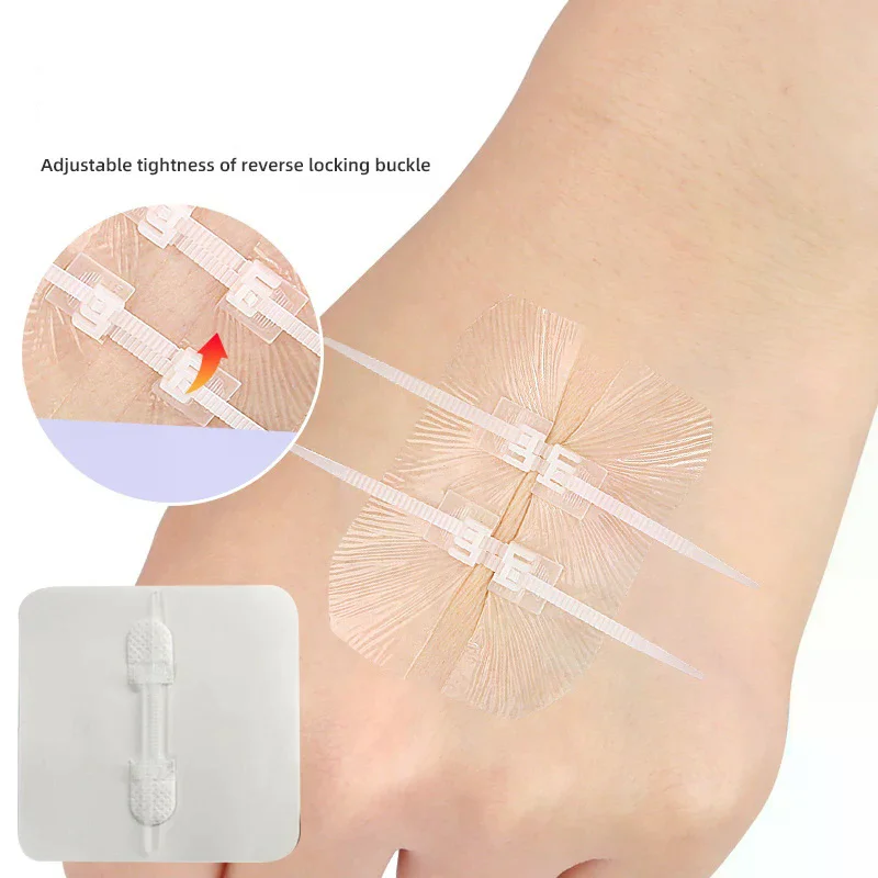 Zipper Band-Aid Painless Wound Closure Device Suture-Free Wound ...