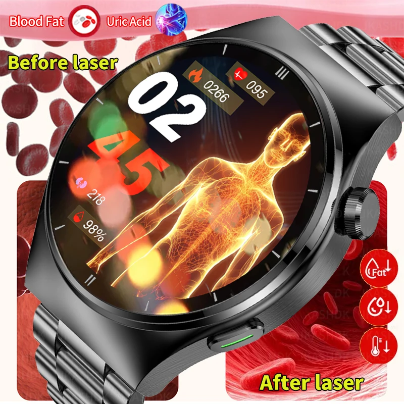 ECG-PPG-Laser-Therapy-Blood-Lipids-Uric-Acid-Blood-Glucose-Smart-Watch ...