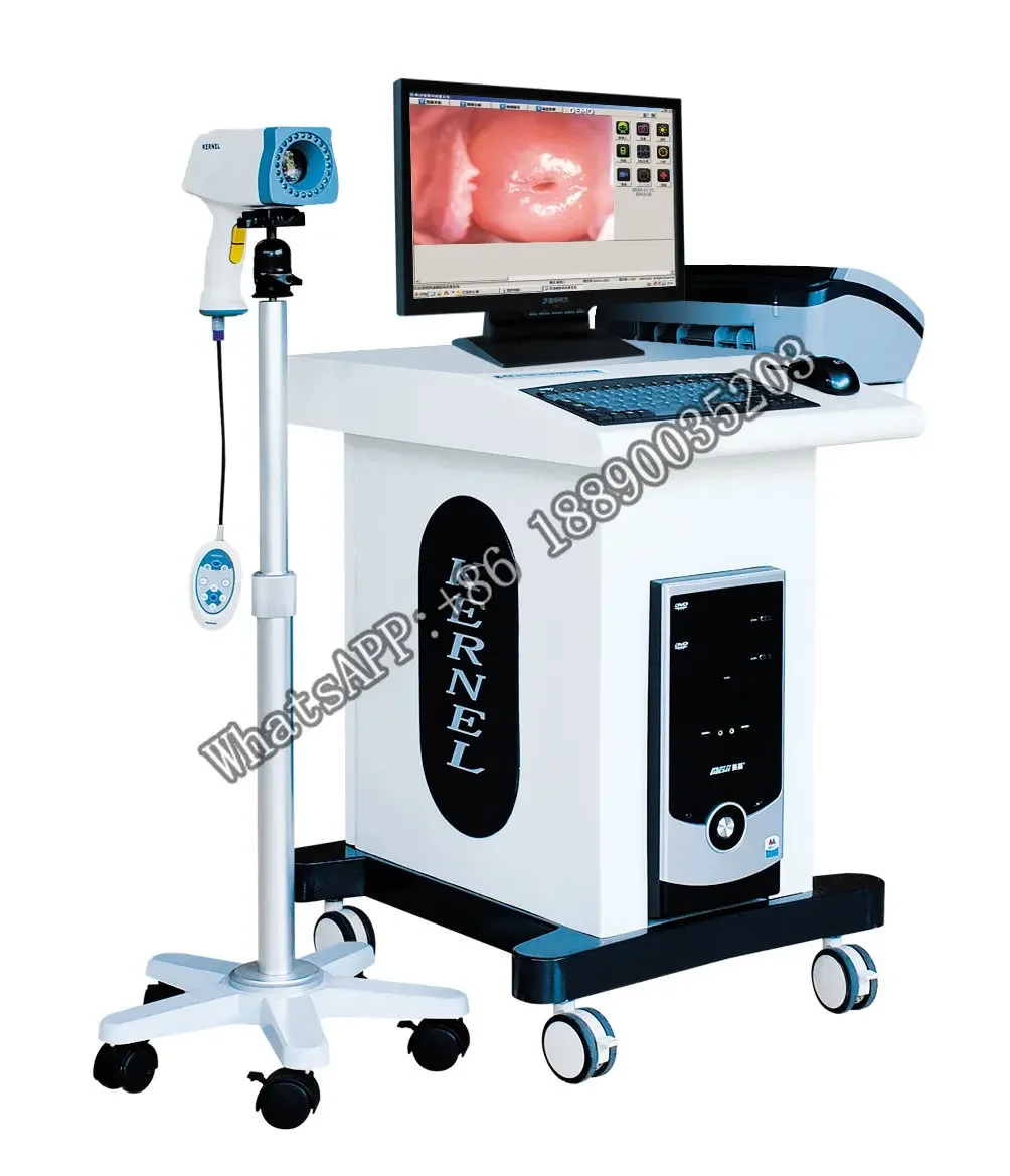 Colposcopia-Digital-port-til-endoscopio-de-v-deo-para-Ginecolog-a-cl ...