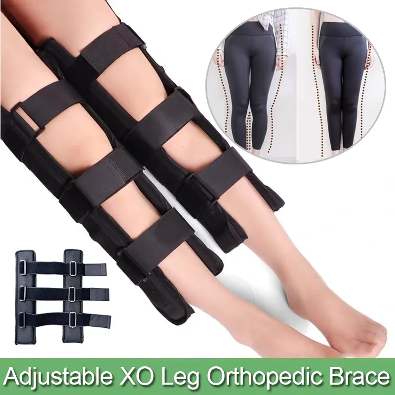 Adjustable Effective Bow Type O Leg Correction Belt-Knee Valgum ...