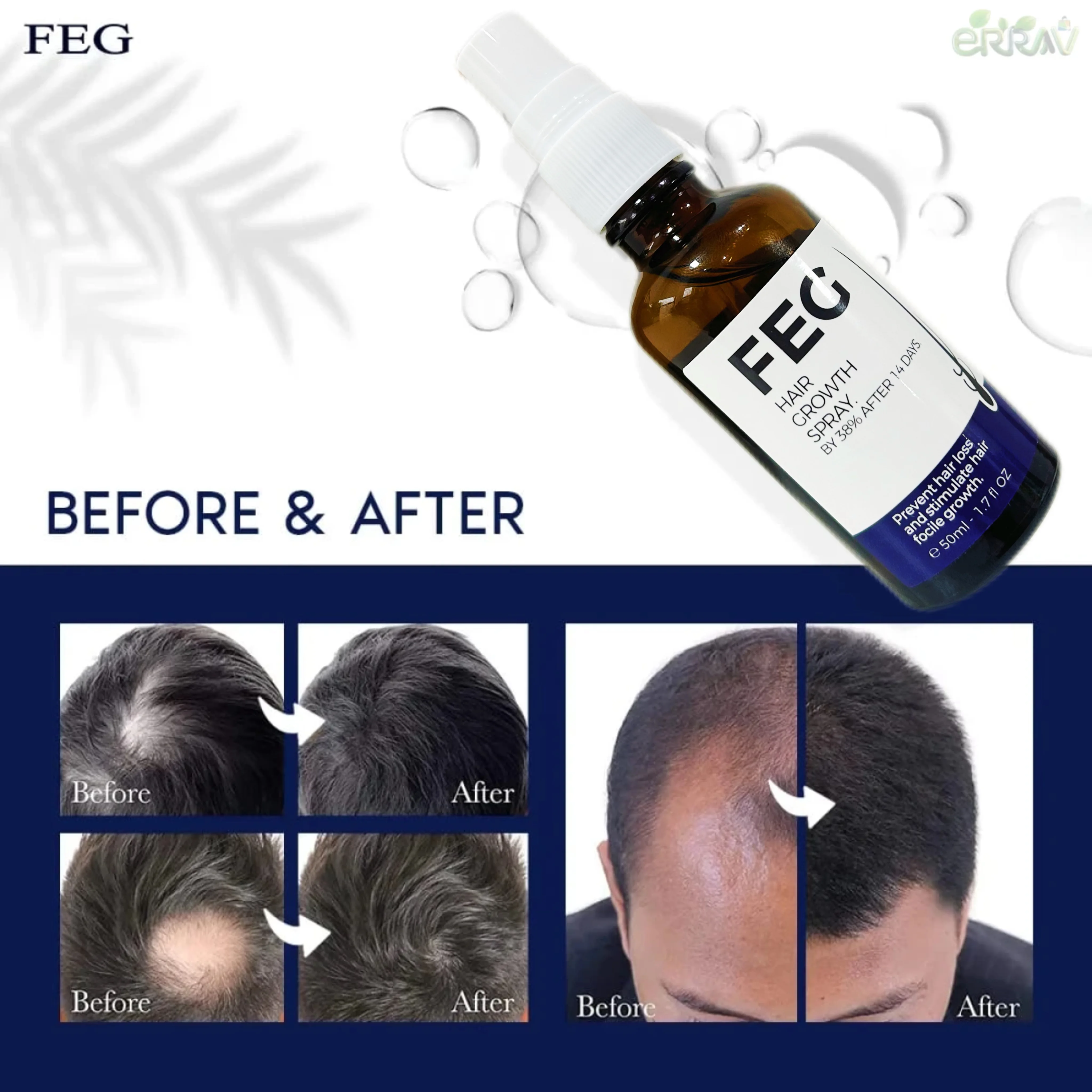 50mL-FEG-hair-growth-spray-precent-hair-loss-stimulate-hair-focile-growth-ownning-Longer-thicker ...