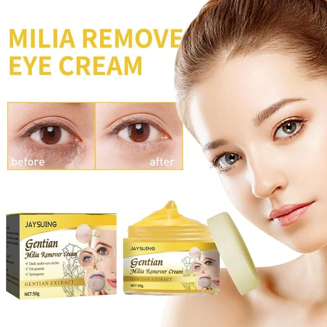 Milia Removal Cream