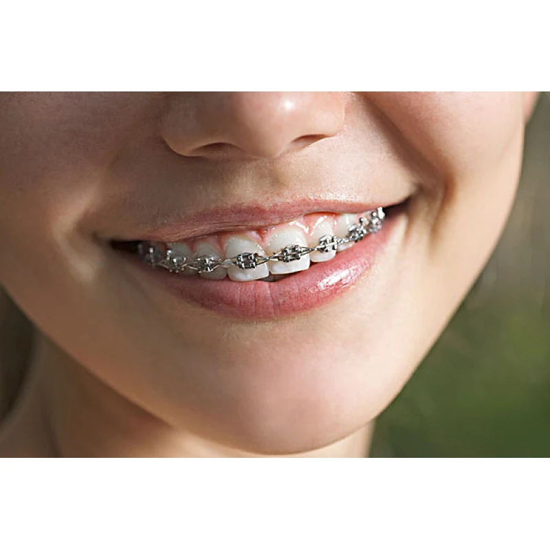 Soportes-de-odontolog-a-para-dientes-10-pares-venta-al-por-mayor ...