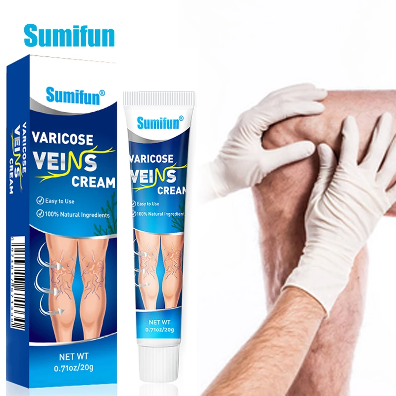 Sumifun Varicose Veins Treatment Cream Effective Cure Leg Acid ...