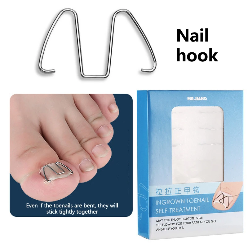 Ingrown-Toenail-Correction-Tool-Ingrown-Toe-Nail-Treatment-Nail-Hook ...