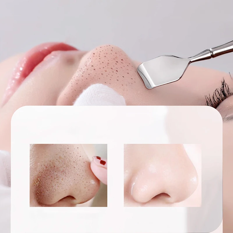 Black-Dot-Pimple-Blackhead-Remover-Tool-Needles-For-Squeezing-Acne ...