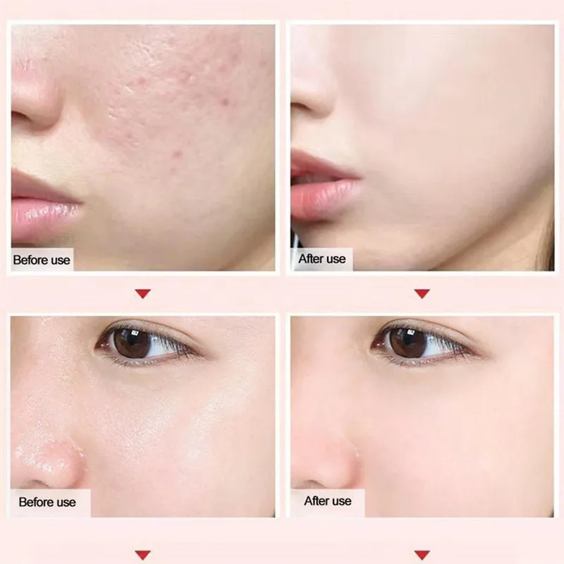 Dull Skin Tone