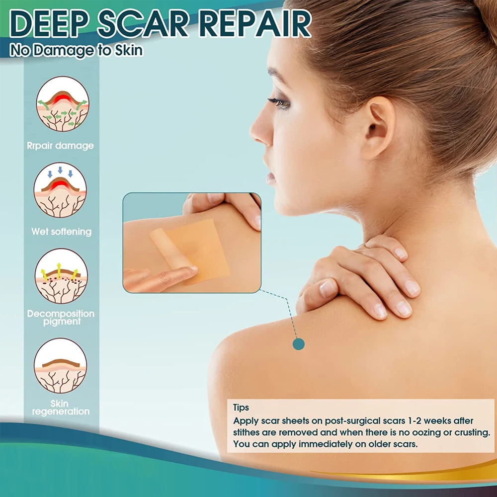Silicone Sheeting For Scar Removal