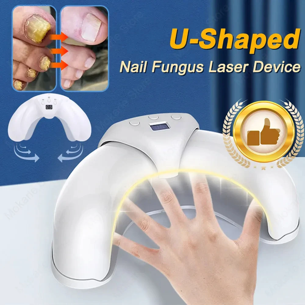 Fungal-Nail-Laser-Repair-Toenail-Fingernail-Fungus-Treat-Cure-Machine ...
