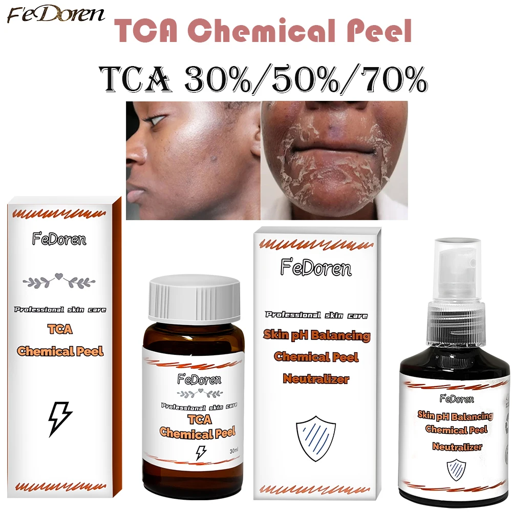 Juego de Peeling químico TCA 50%, Peeling con ácido y ácido 70 neutralizador, superfuerza ...