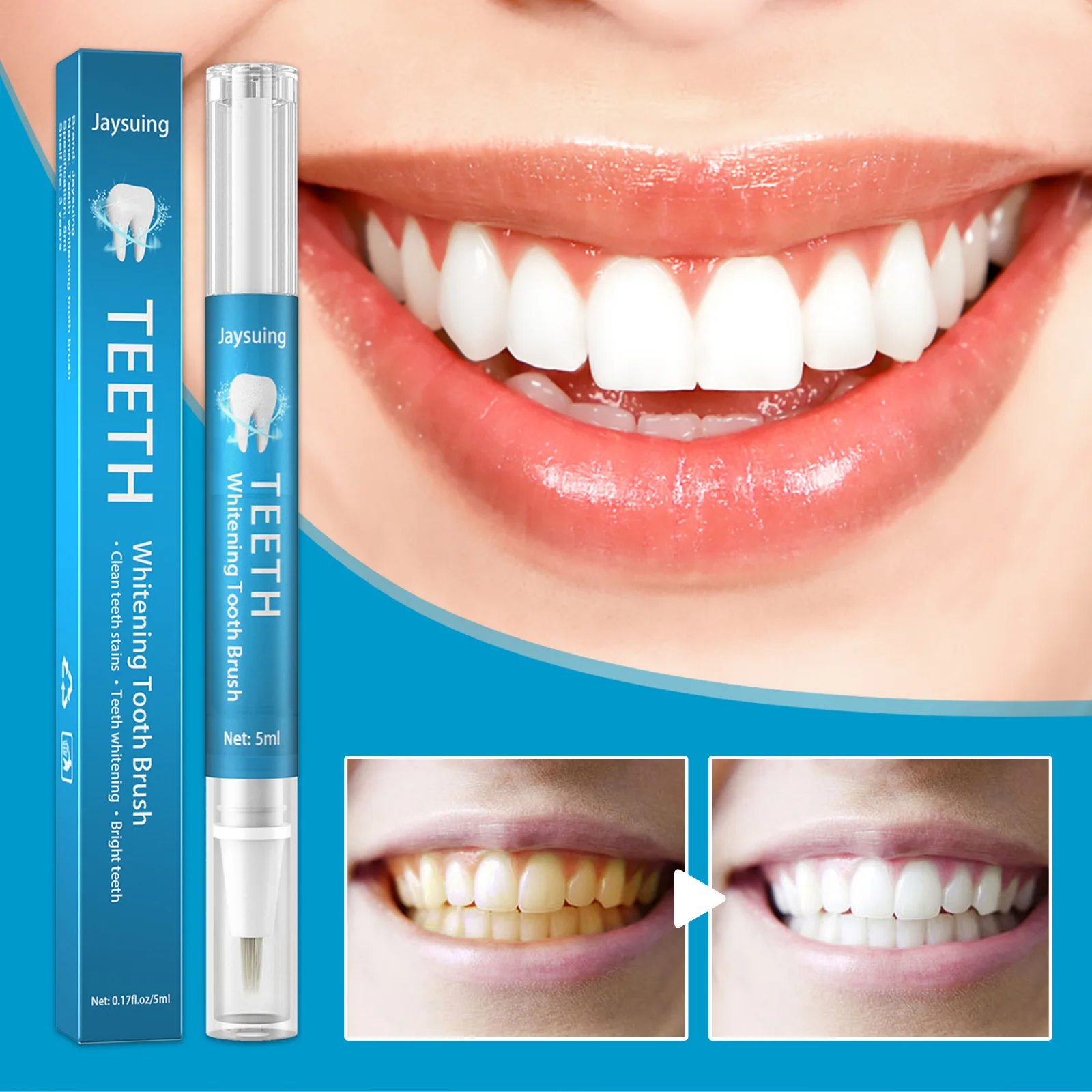 Portable-Teeth-Whitening-Pen-Tooth-Gel-Whitener-Bleach-Remove-Stain ...
