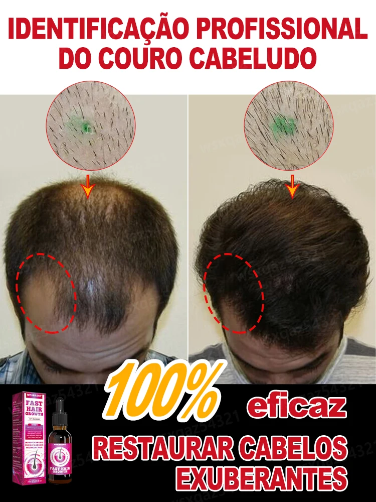 F-rmula-100-natural-de-plantas-crescimento-poderoso-do-cabelo ...