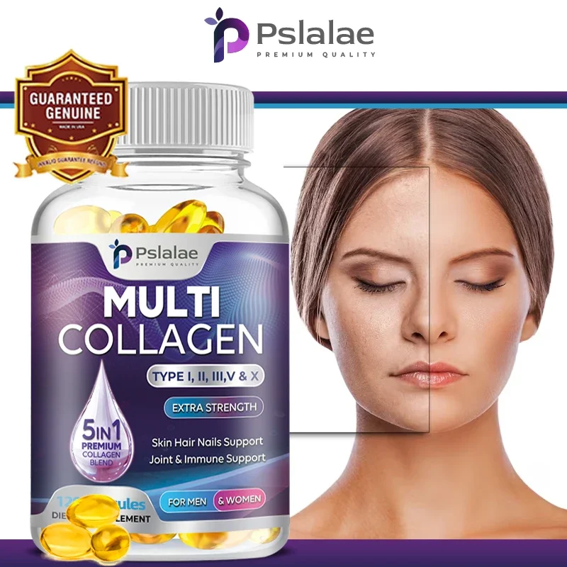 Multiple Collagen Complex - Type I, II, III, V, X, Grass Fed and Non ...