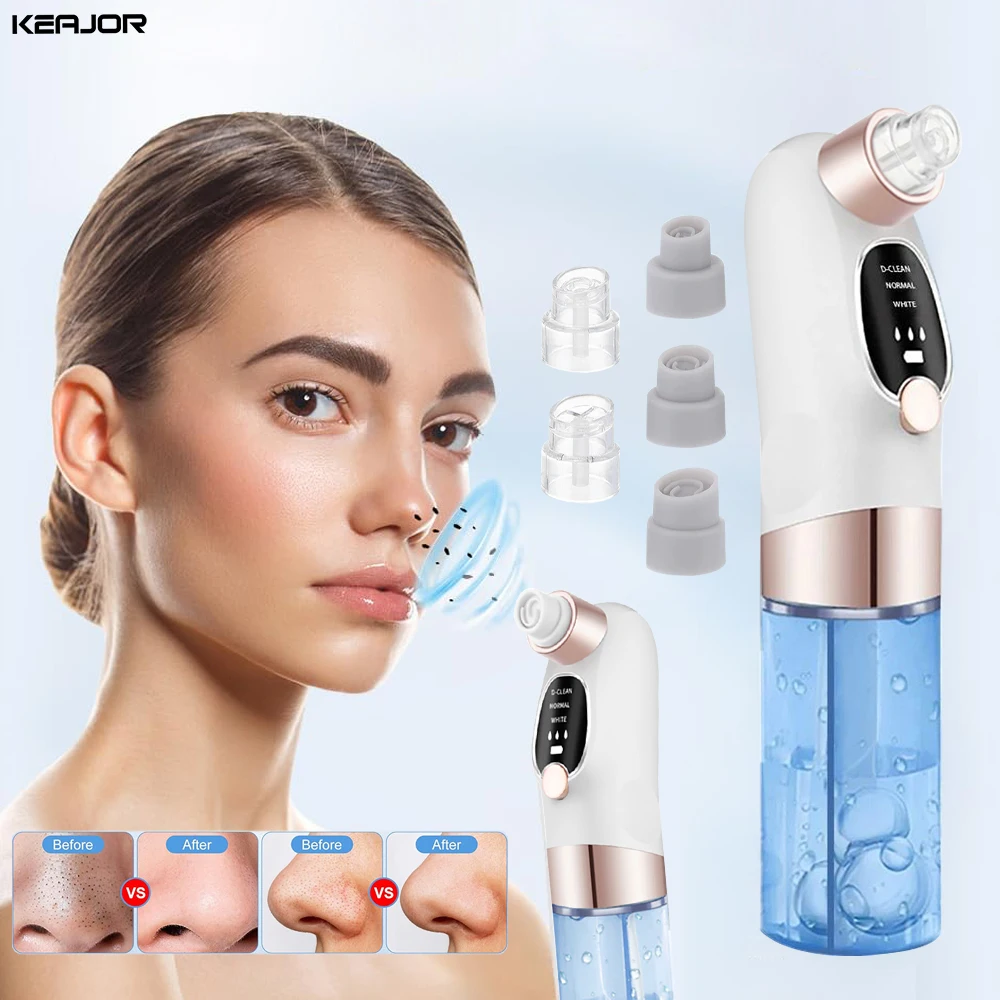 Vacuum Cleaner with Face: The Real Deal for Deep Pore Cleaning and ...