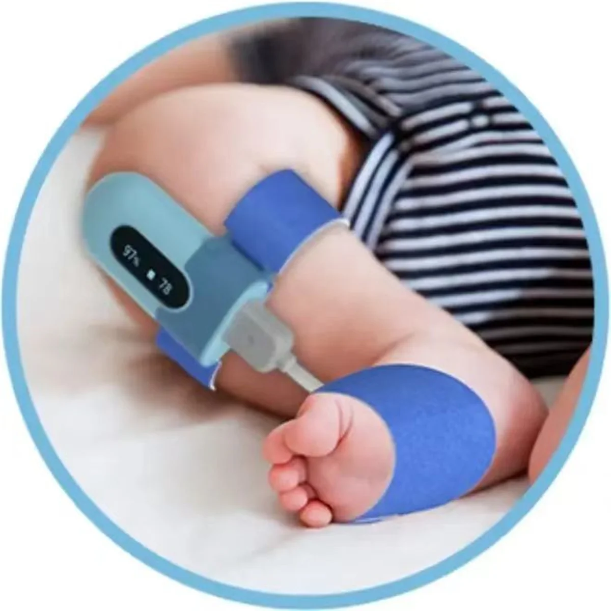 Wellue-BabyO2-Smart-Sock-Baby-Pulse-Oximeter-Bluetooth-Neonatal-Pulse ...