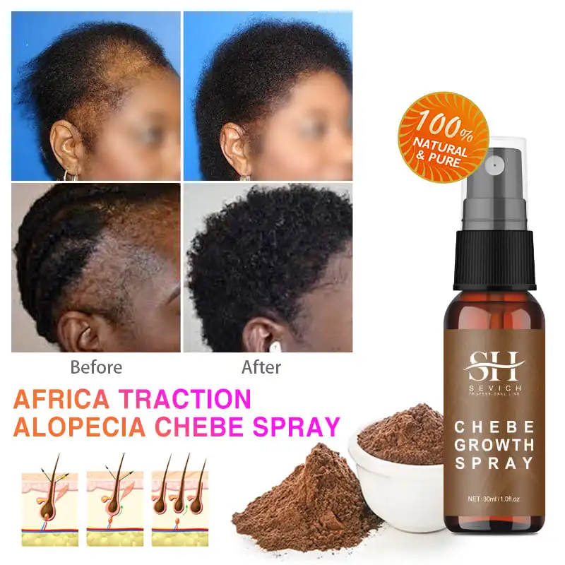 Sevich Chebe Hair Growth Spray 30ml Africa Traction Alopecia Hair ...