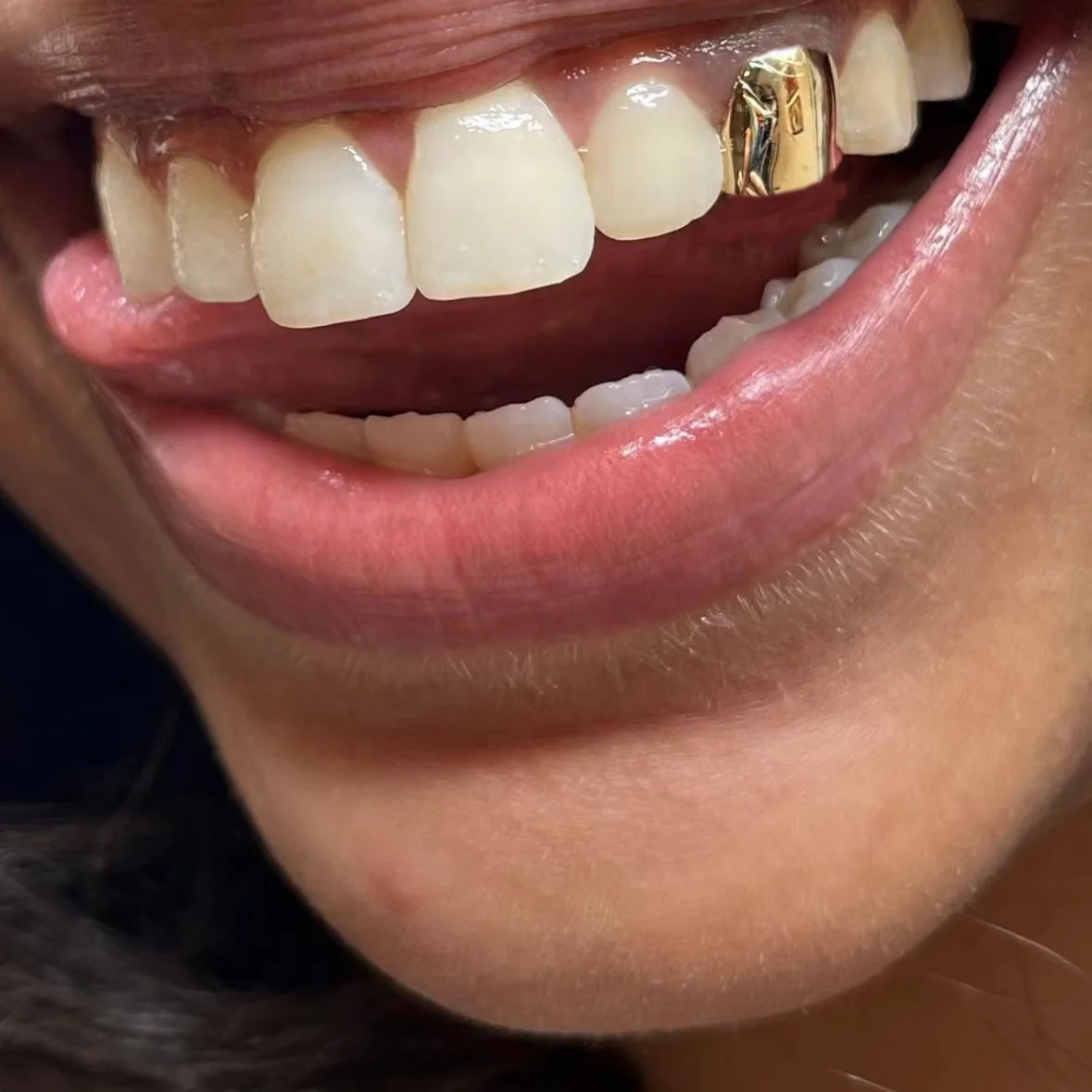 RACHELZ-Classic-Single-Glossy-Teeth-Grillz-Hip-Hop-14K-Gold-Plated ...