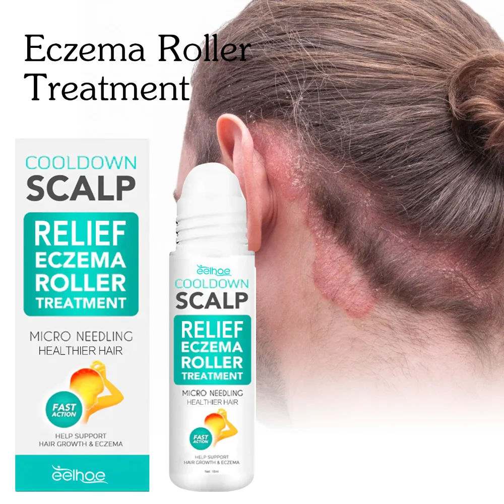 Head-Acne-Itching-Scalp-Ringworm-Skin-Problems-Seborrheic-Skin-Cream ...