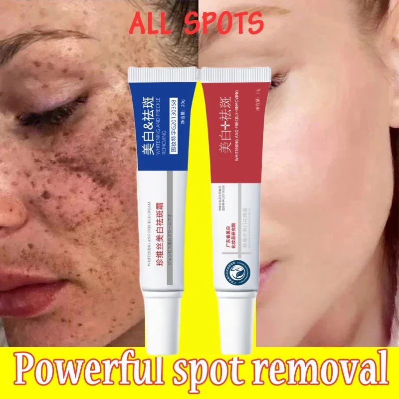 Freckle Cream Effective Eliminate Brown Stain Melasma Melanin Blemish ...