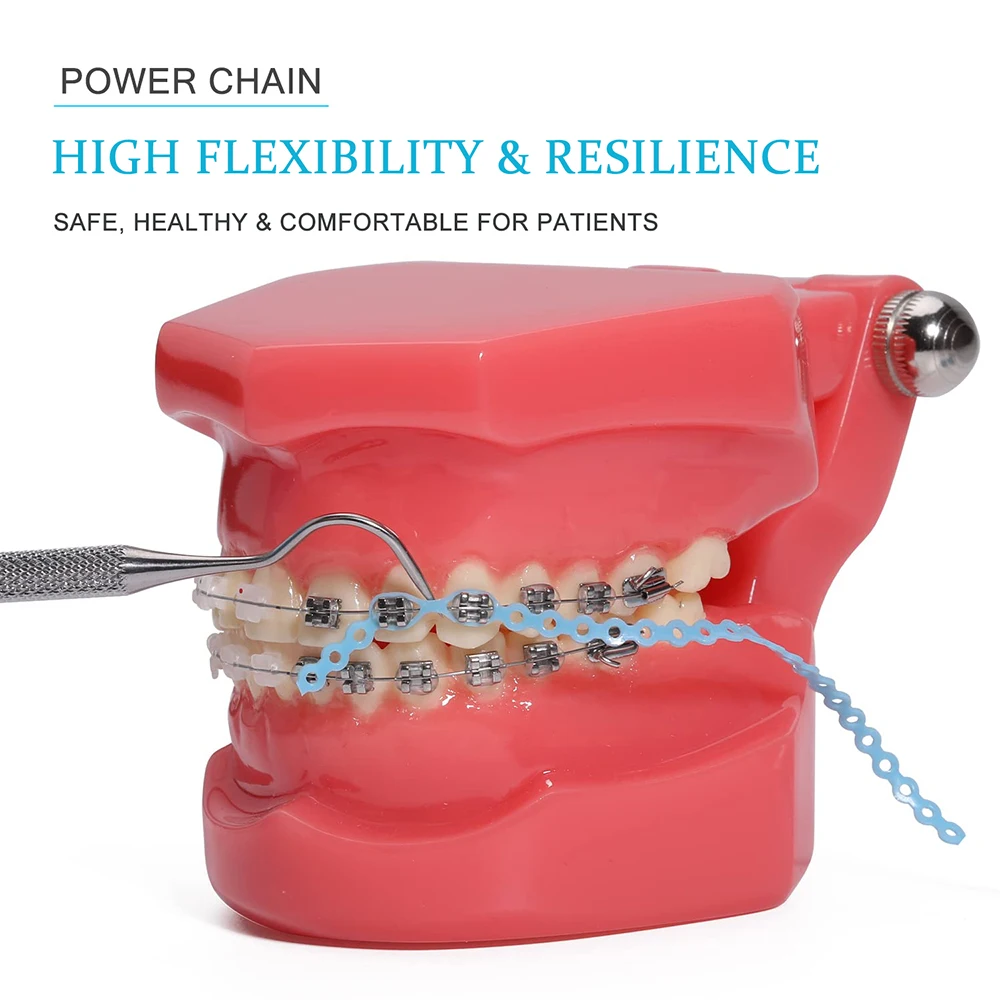 Braces Chain Rubber Bands