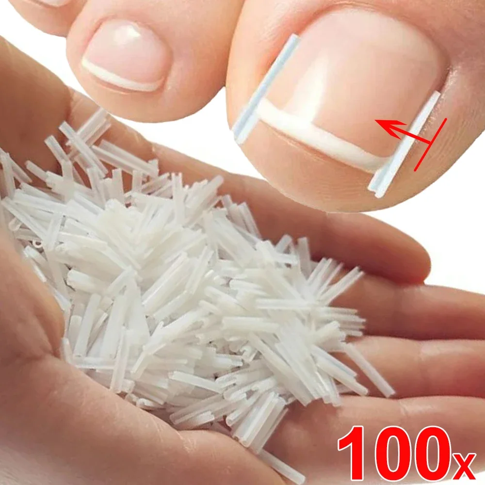 1-100PCS-Ingrown-Toenail-Correction-Ultra-thin-Nail-Treatment-Elastic ...