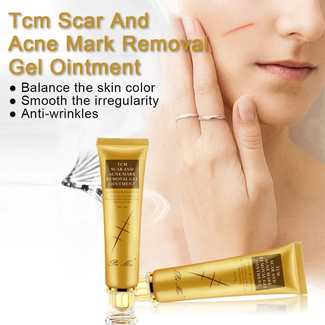 Acne Scars Removal Cream