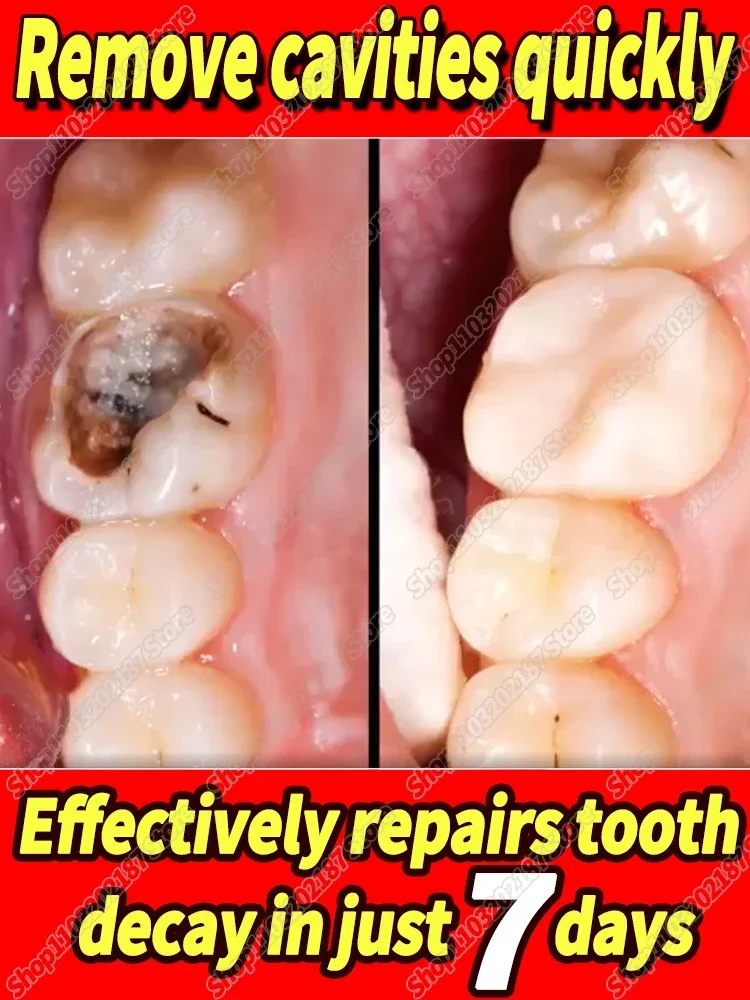 Teeth-whitening-anti-cavity-tooth-decay-fresh-bad-breath-repair-tooth ...