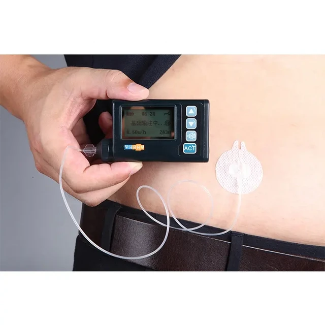 Pompa Per Infusione Ambulatoriale Esterna Di Insulina