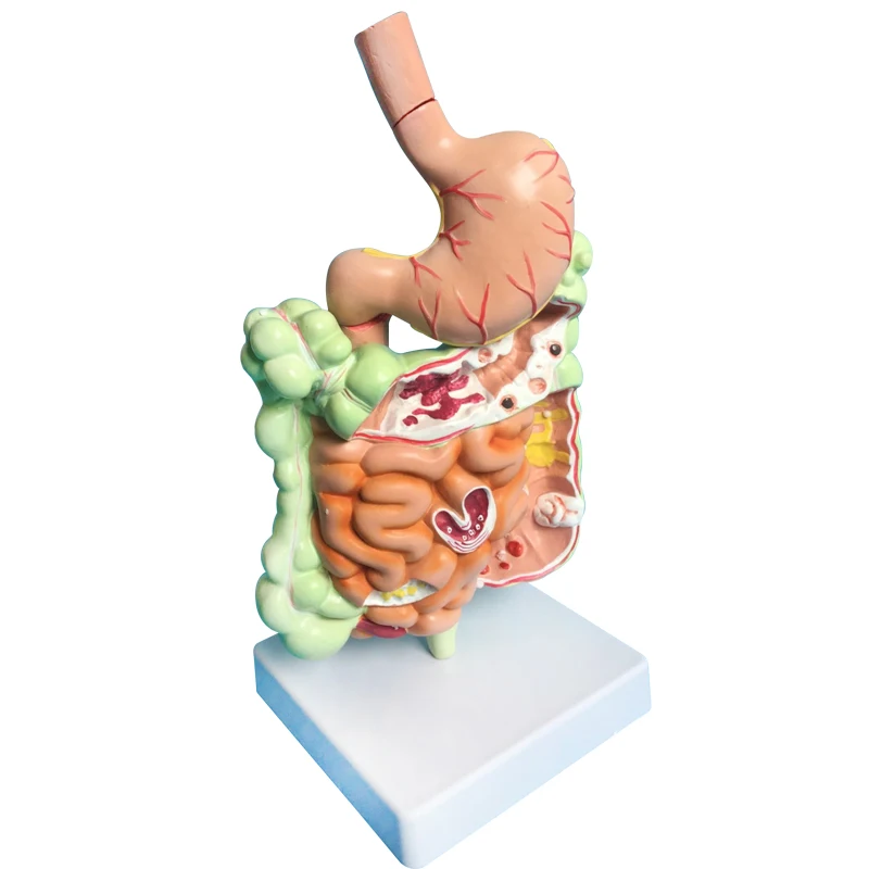 Large Intestine Anatomy Model