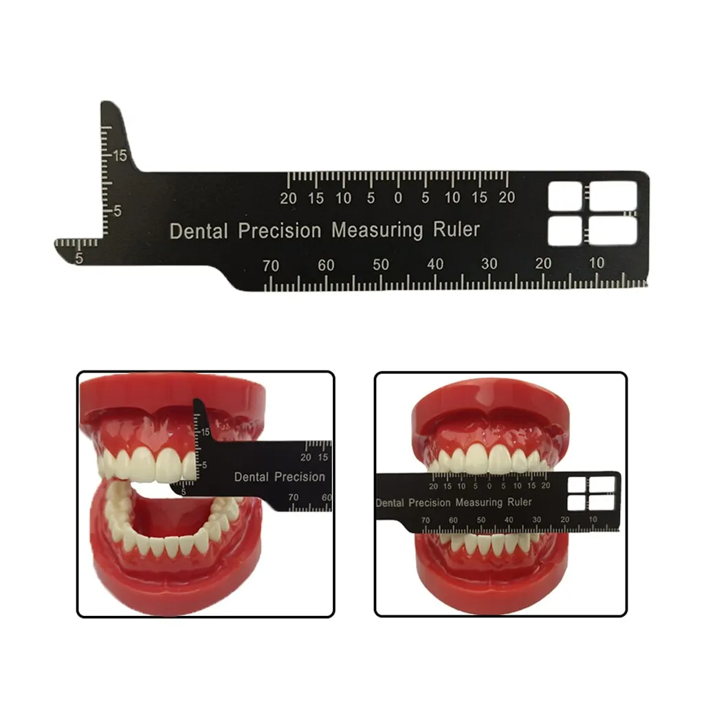 1pc Dental Precision Measuring Ruler Orthodontic Tool For Photography ...
