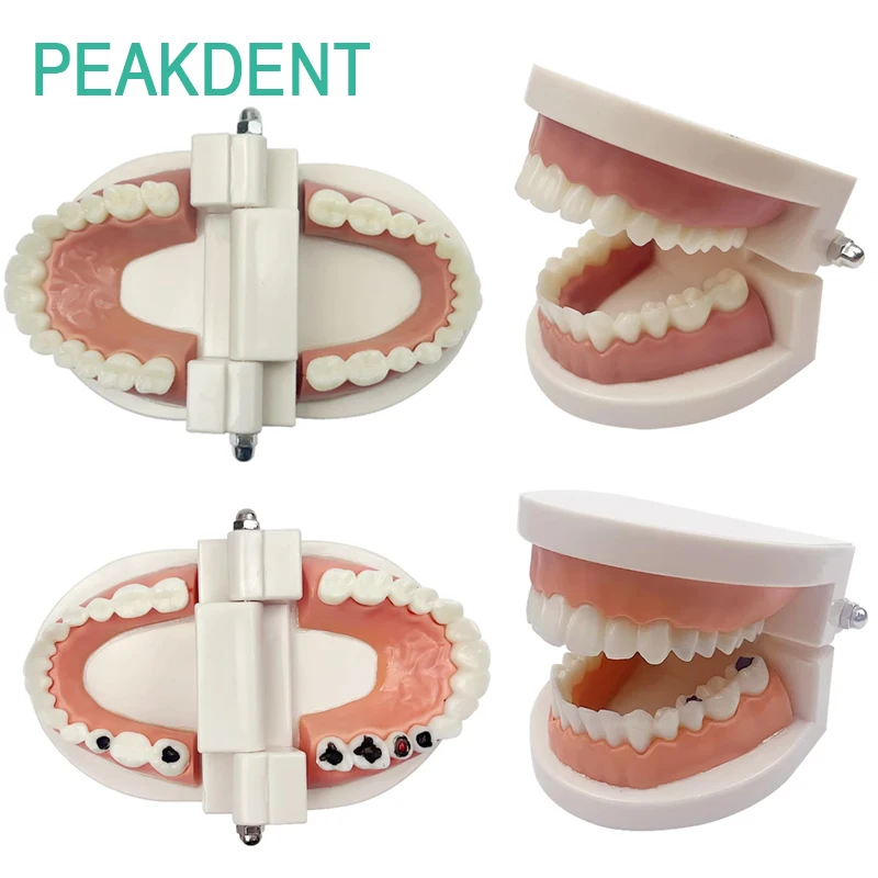 1PC Standard Dental Adult Teeth Model Teaching Study Typodont ...